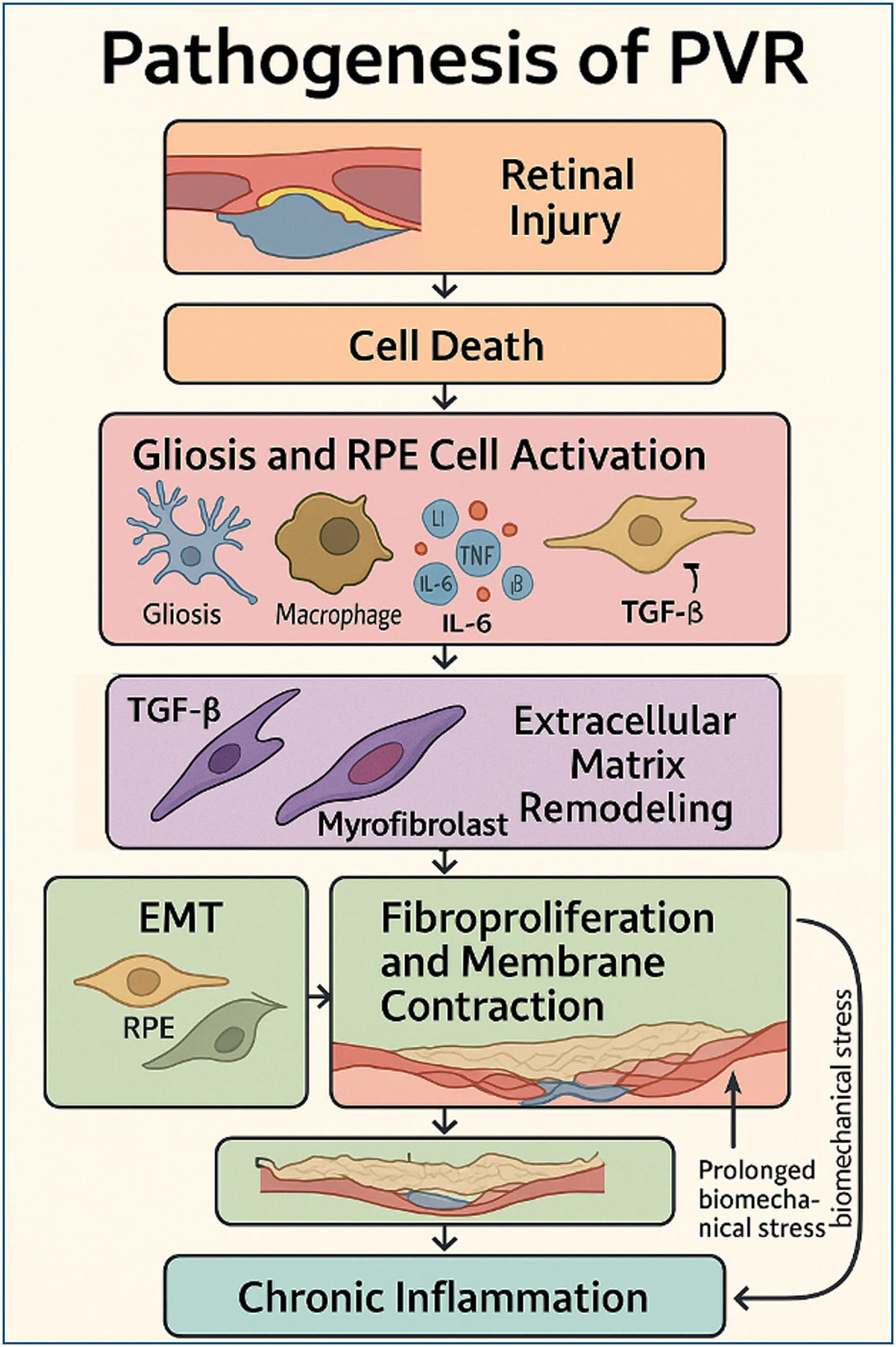 Proliferative vitreoretinopathy: update in prevention and treatment ...